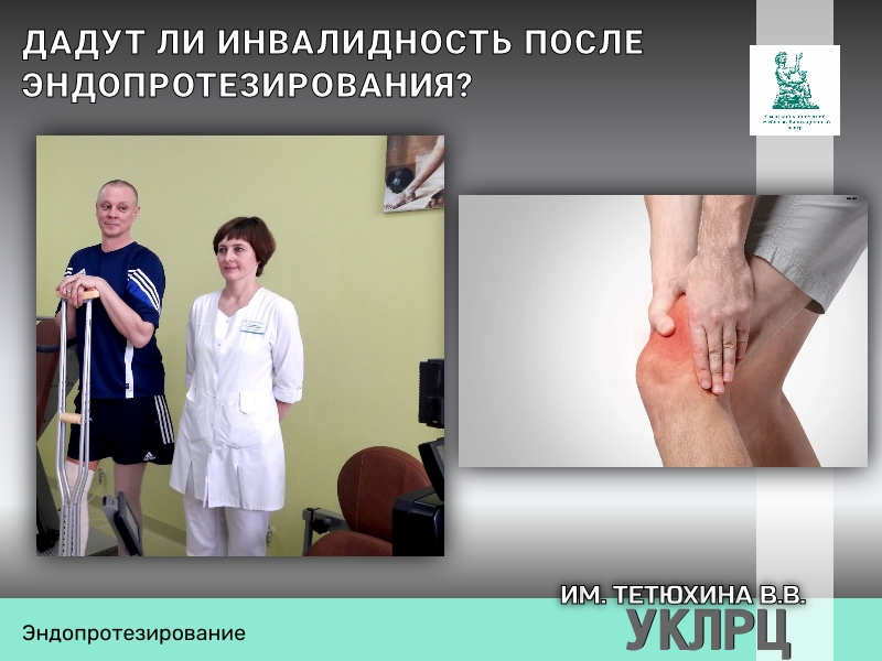 ДАДУТ ЛИ ИНВАЛИДНОСТЬ ПОСЛЕ ЭНДОПРОТЕЗИРОВАНИЯ Само по себе наличие